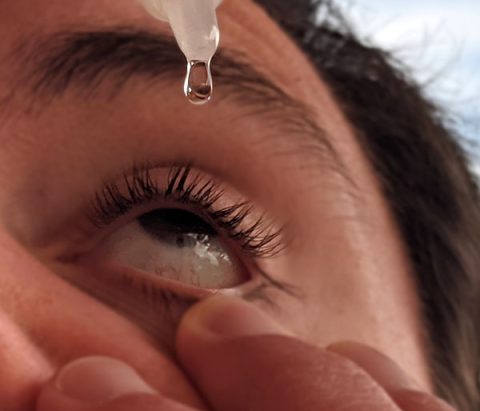Dry Eye Treatment - Hillcrest Vision | Optometrists